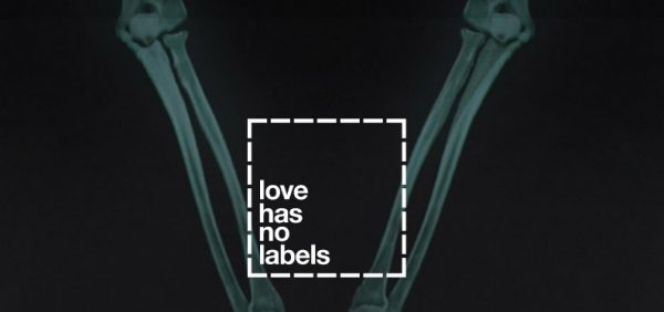 Love Has No Labels, la radiografía del amor en estado puro